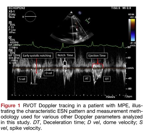 Pocus And Pe A Deep Dive