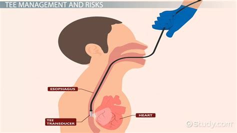 Transesophageal Echocardiogram Tee Patient Monitoring And Management Lesson