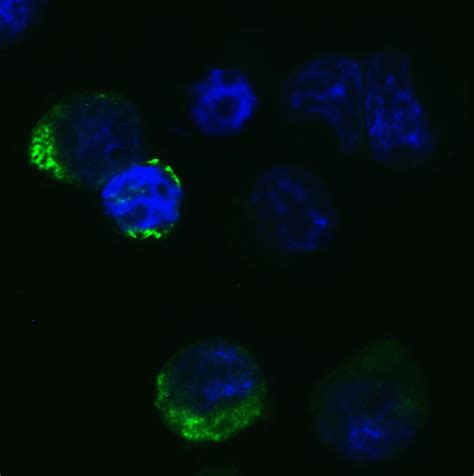 SARS CoV 2 Spike Protein RBD Antibody PA5 114529