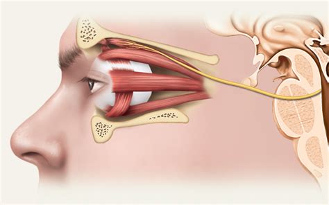 Cranial Nerve Iv Trochlear Diagram Quizlet