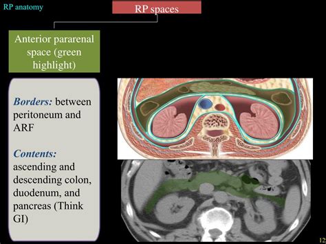 PPT Overview Of Retroperitoneal Anatomy Masses And Disease Spread