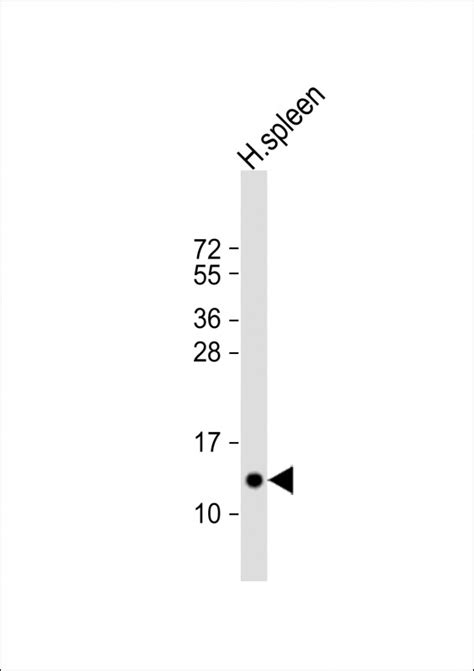 PF4 Antibody - Cat. No. 61-201 | ProSci