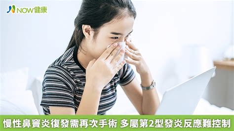 慢性鼻竇炎復發需再次手術 多屬第2型發炎反應難控制