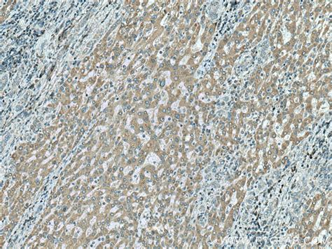 Mthfd1l Antibody 16113 1 Ap Proteintech