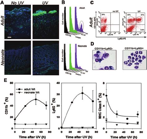 Uv Irradiation Induces Infiltration Of Cd11b ϩ Ly6g ϩ Cells In Adult