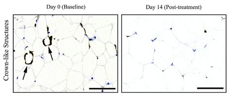 New Anti Aging Drug Combo Shows Promise In Humans