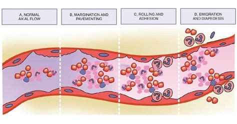 Acute Inflammation Cellular Events New