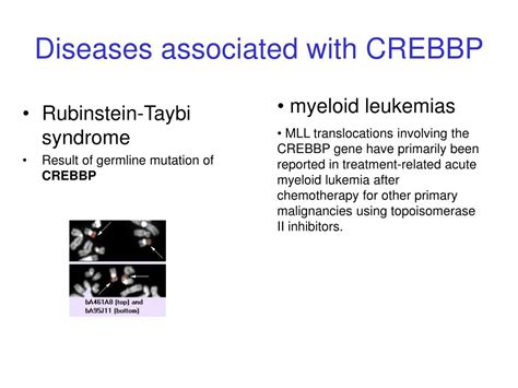 Ppt What Is So Memorable About Crebbp Powerpoint Presentation Free