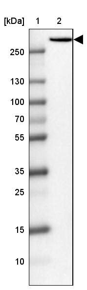 Rabbit Polyclonal Anti Itpr1 Antibody Buy For Research Highly Specific Rigorously Validated