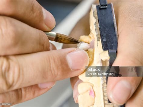 치과 기술자 치아에 세라믹을 적용의 용광로에 올려 놓기 전에 임 플 란 트 Stem 주제에 대한 스톡 사진 및 기타 이미지