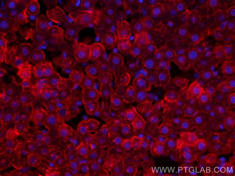 Asgr1 Antibody Cl594 11739 Proteintech 武汉三鹰生物技术有限公司