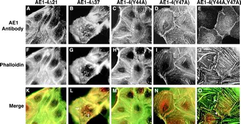 Localization Of Ae1 4 Mutants In Subconfluent Mdck Monolayers Mdck