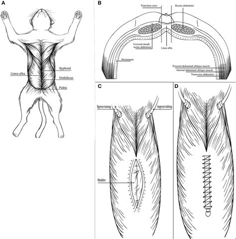 A Cat In Dorsal Recumbency After Reflecting The Skin And Download Scientific Diagram A Cat In Dorsal Recumbency After Reflecting The Skin And Download Scientific Diagram