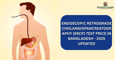 Ercp Test Price In Bangladesh 2025 Updated Hospitalbangla