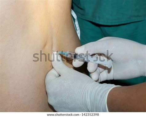 28 Caudal Epidural Block Royalty Free Photos And Stock Images Shutterstock