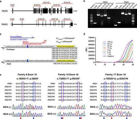 Mutation Analysis Of PKD1 And PKD2 A The Diagrammatic Images Of PKD1