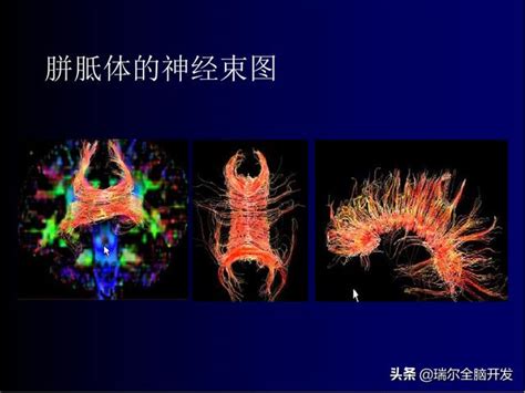 對大腦的認識除了左右腦還有哪些下 每日頭條