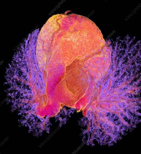 Human Heart 3d Ct Angiogram Stock Image C0400976 Science Photo