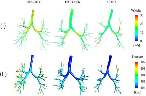 Hydrodynamic Simulations Performed In The Airway Model Visualisation