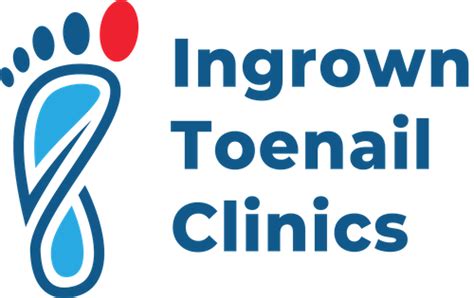 Ingrown Toenail Clinic Ingrown Toenail Treatment Sydney