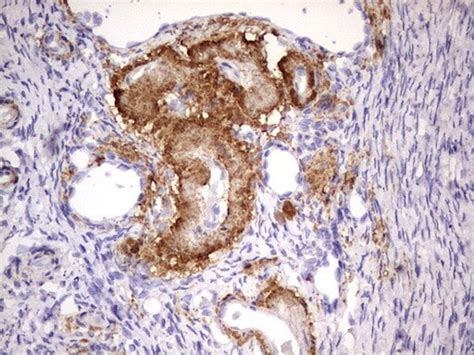 Ikzf3 Antibody Ma5 26668