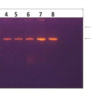 PCR Amplification Of The 16S RRNA Gene Using The Universal Primer Pair