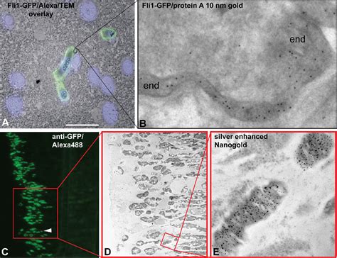 Figure 1 From Correlative Light And Electron Microscopy In The