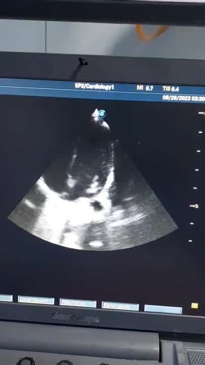 Spot Diagnosis In Neonate 5 Day Old Azza Makram