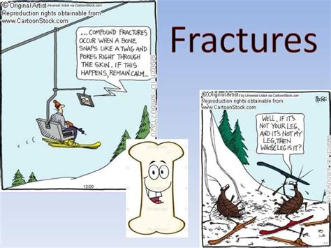 Ppt Fractures Powerpoint Presentation Free Download Id2017002