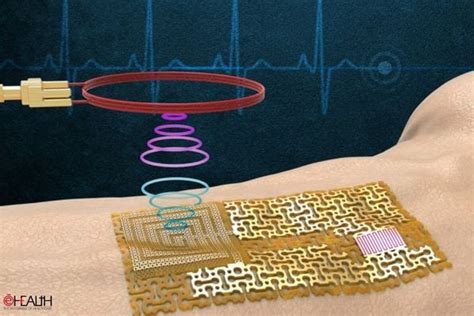 Mit Engineers Develop E Skin An Ultra Thin Wearable Health