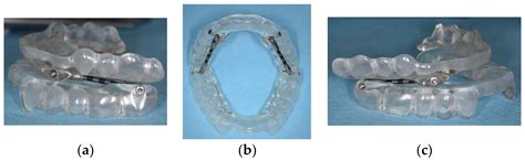 Ada Code Mandibular Advancement Device At Michael Sizemore Blog