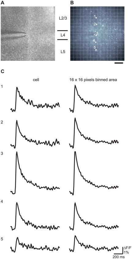 Spatiotemporal Properties Of The Action Potential Propagation In The