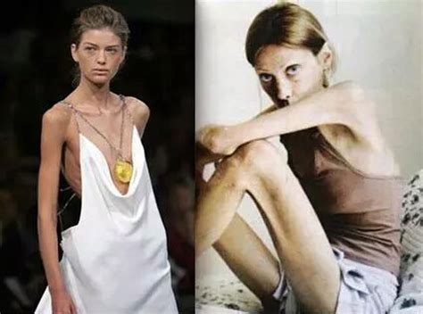 Isabelle Caro Modeling