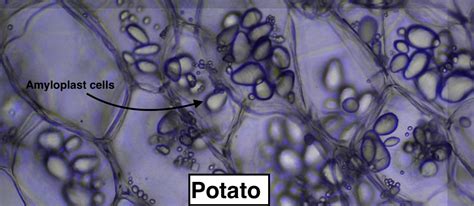 Amyloplasts Storea Glycogenb Starchc Fatd Protein