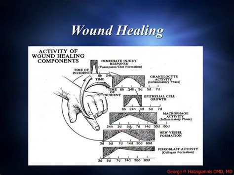 Soft Tissue Trauma Introduction Ppt
