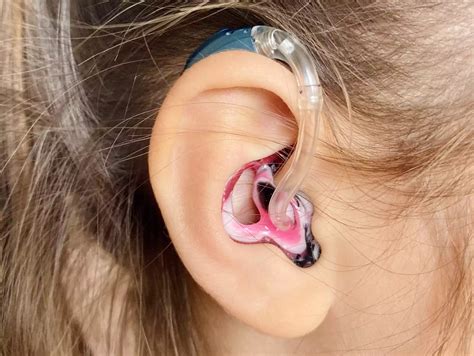 Prolonging The Life Of Hearing Aids A Guide To Maintenance And Care