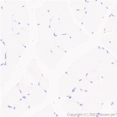 Anti Sirp Alpha Antibody [epr24187 17] Ab259357 Abcam