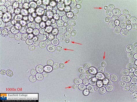 Saccharomyces Under Microscope 400x