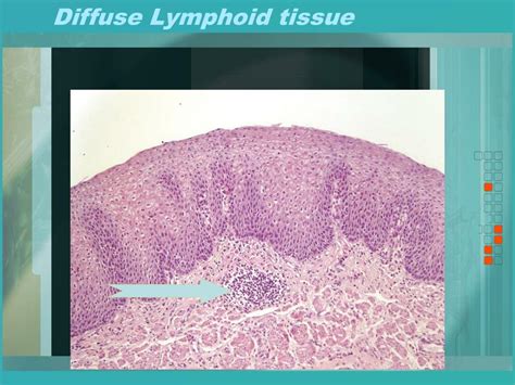 Ppt Its The Immune System Powerpoint Presentation Free Download