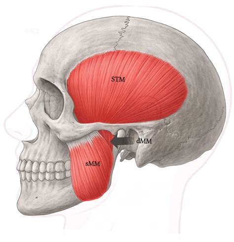 The Deep Head Of The Masseter Muscle A Classification Based Anatomical And Surgical Framework