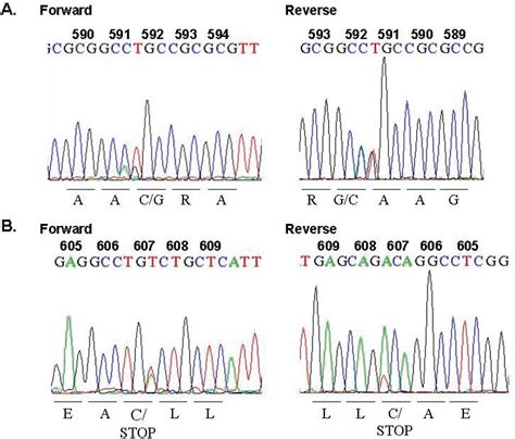 Detection Of A Ul97 Gene Mutation Conferring Ganciclovir Resistance In