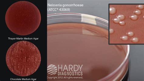 Modified Thayer Martin Agar Composition Preparation And Principle