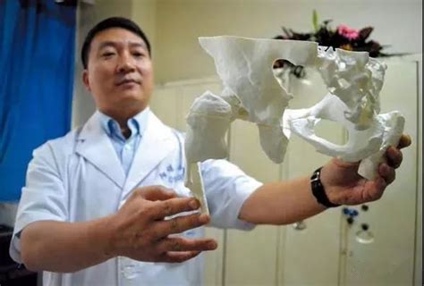 借助3d打印技术！阳煤总医院实现骨科手术“私人订制”