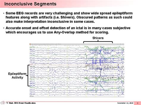 EEG Event Classification Using Deep Learning Vinit Shah