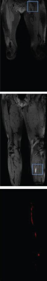 Representative Segmentation Results Of A Patient Obtained From An