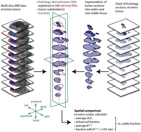 data processing workflow for spatial comparison of dce mri data and