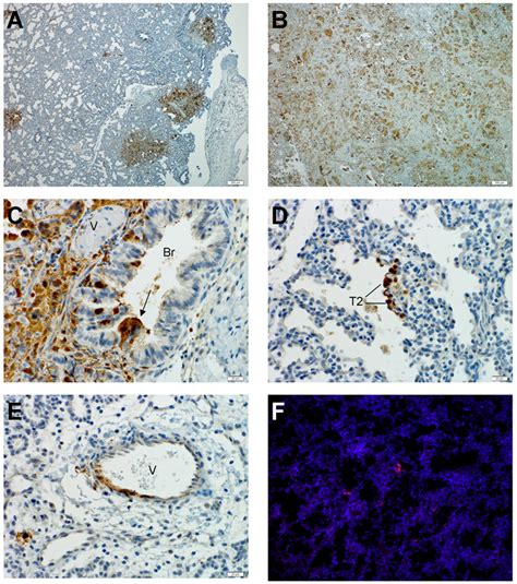 Nipah Virus Tropism In Human Lung Xenografts Lung Sections Were Download Scientific Diagram