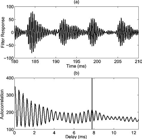 Figure 1 From Monaural Speech Segregation Based On Pitch Tracking And