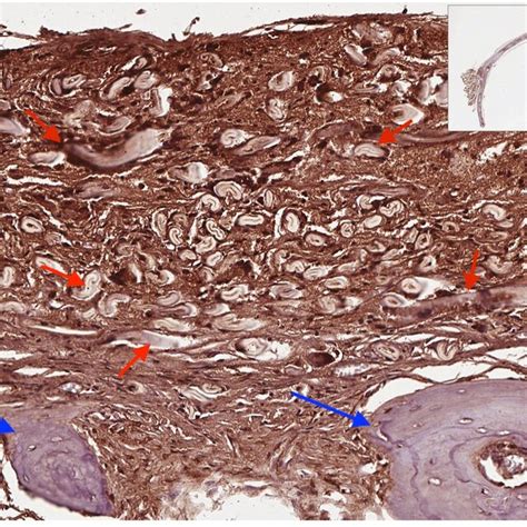 Higher Magnification Image Of The Center Of The Bony Defect Showing The