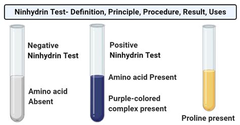 Ninhydrin Test Principle Reaction Reagents Procedure Test Of Proteins